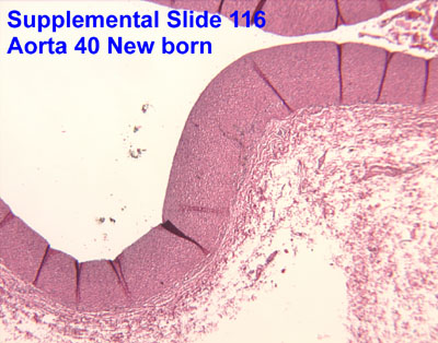 Aorta Microscope Image Labeled